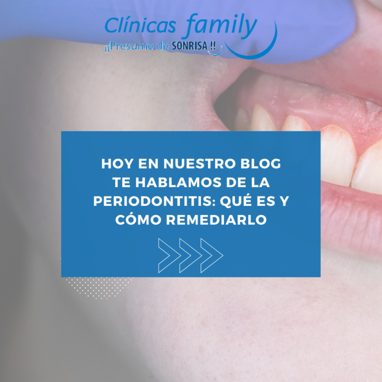 ¿QUÉ ES LA PERIODONTITIS? - Clínicas Family